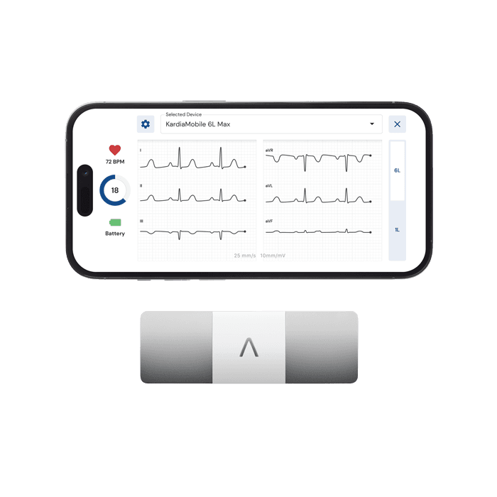 EKG Monitor with 6 Leads | KardiaMobile 6L Max by AliveCor