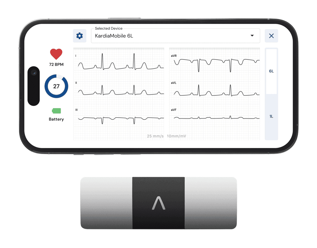 EKG Monitor with 6 Leads | KardiaMobile 6L by AliveCor
