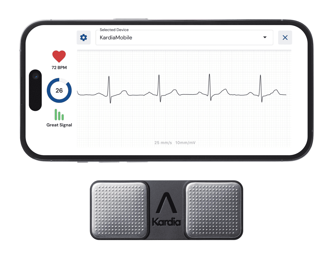 KardiaMobile EKG Monitor - Instant EKG on Your Phone | AliveCor