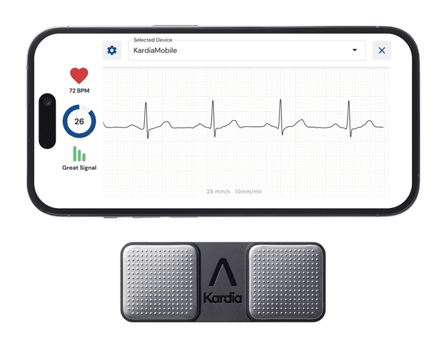 KardiaMobile EKG Monitor - Instant EKG on Your Phone | AliveCor