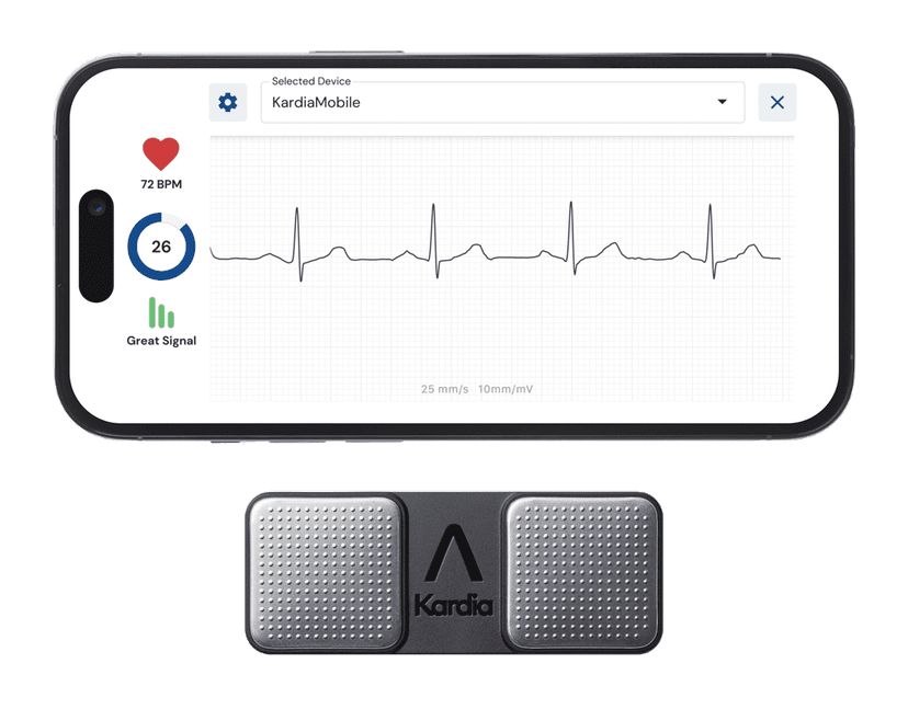 KardiaMobile EKG Monitor - Instant EKG on Your Phone | AliveCor