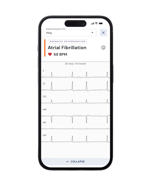 Personal EKG Devices by AliveCor – AliveCor, Inc.
