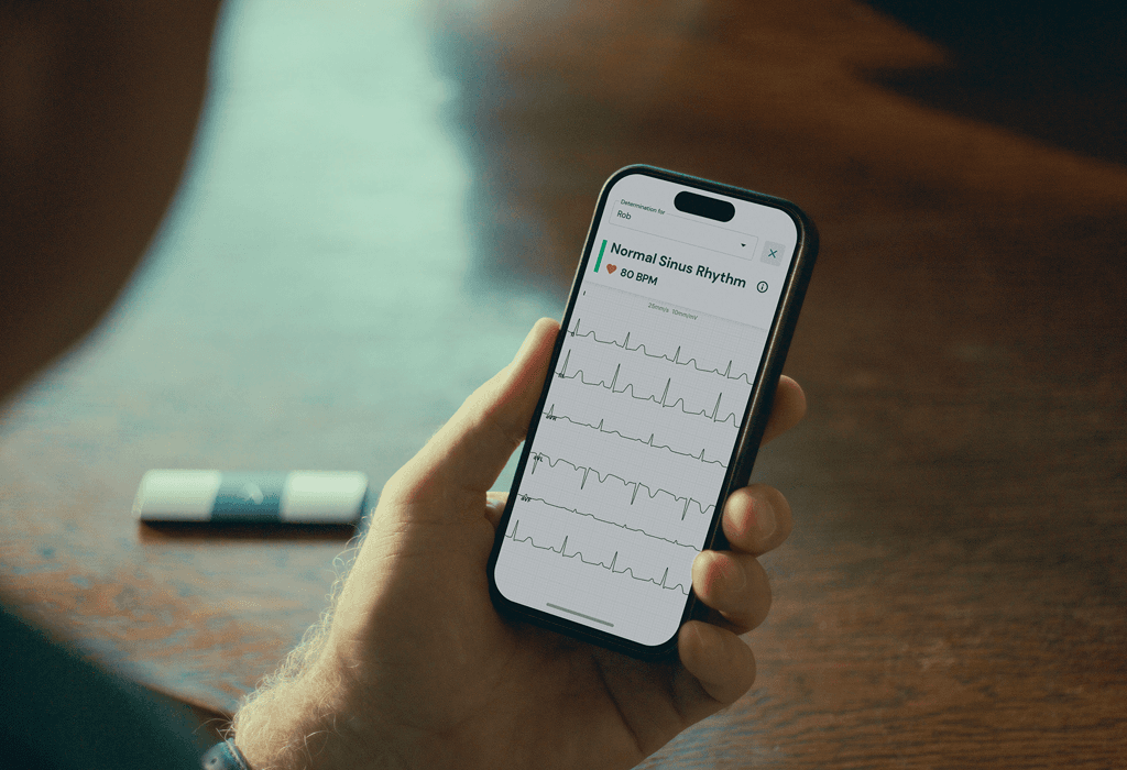 How to Detect AFib: Tests, Monitors, and At-Home Options | Kardia