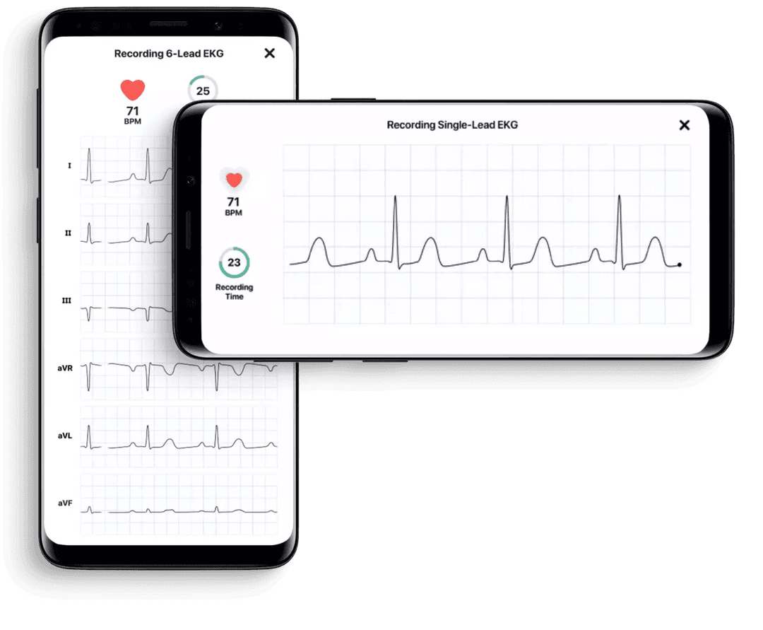 Personal EKG Devices by AliveCor – AliveCor, Inc.